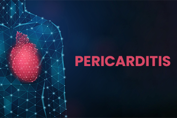 What All You Should Know About Pericarditis - BMB