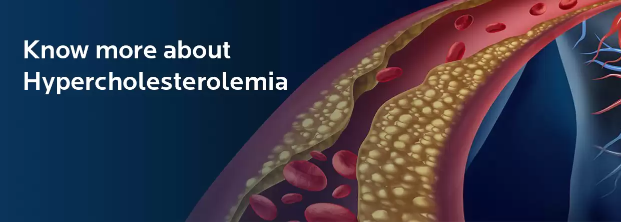 All You Need to Know About Hypercholesterolemia | BM Birla