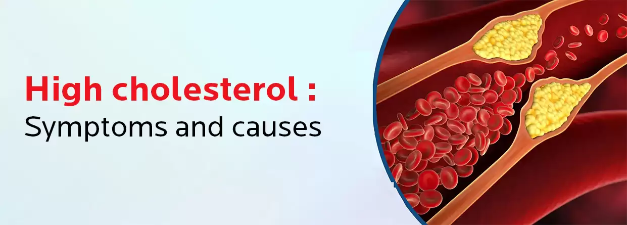 High Cholesterol: Signs, Causes & Effective Treatment Options
