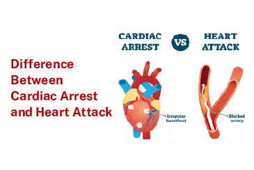 Heart Attack and Sudden Cardiac Arrest Differences