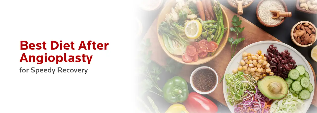 Best Diet After Angioplasty for Speedy Recovery - BMB