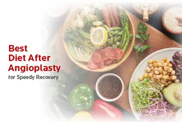 Best Diet After Angioplasty for Speedy Recovery - BMB