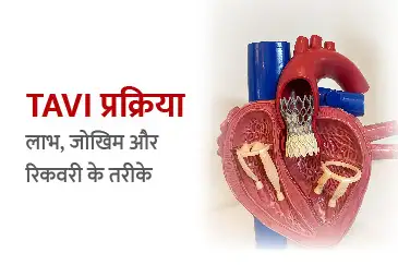 TAVI सर्जरी के लाभ, जोखिम, और रिकवरी के 7 आसान तरीके