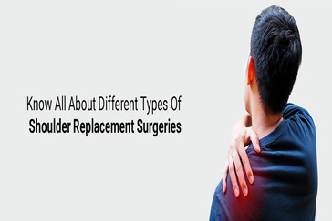 Everything you should know about Shoulder replacement surgery