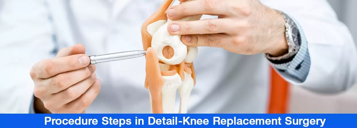 Procedure Steps in Detail-Knee Replacement Surgery - CMRI Kolkata