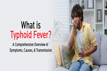 Typhoid - Symptoms, Causes, and Treatment