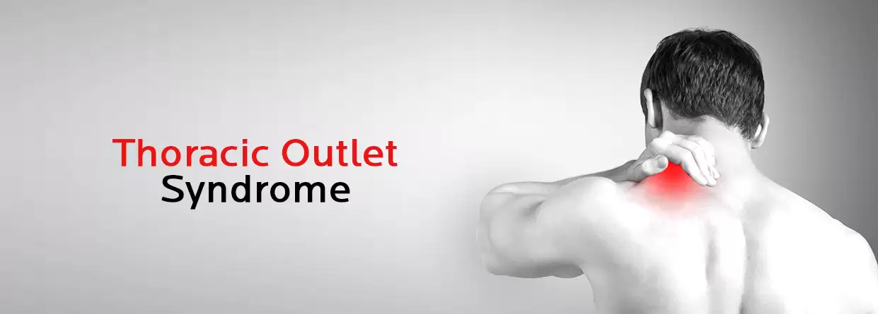 Thoracic Outlet Syndrome- Everything You Need to Know - CMRI