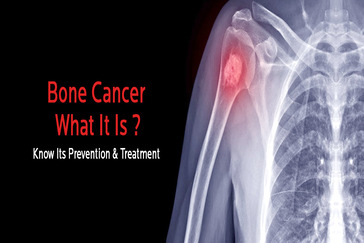 Bone Cancer- All You Need to Know - CMRI