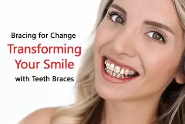 Bracing for Change: Transforming Your Smile with Teeth Braces - CMRI