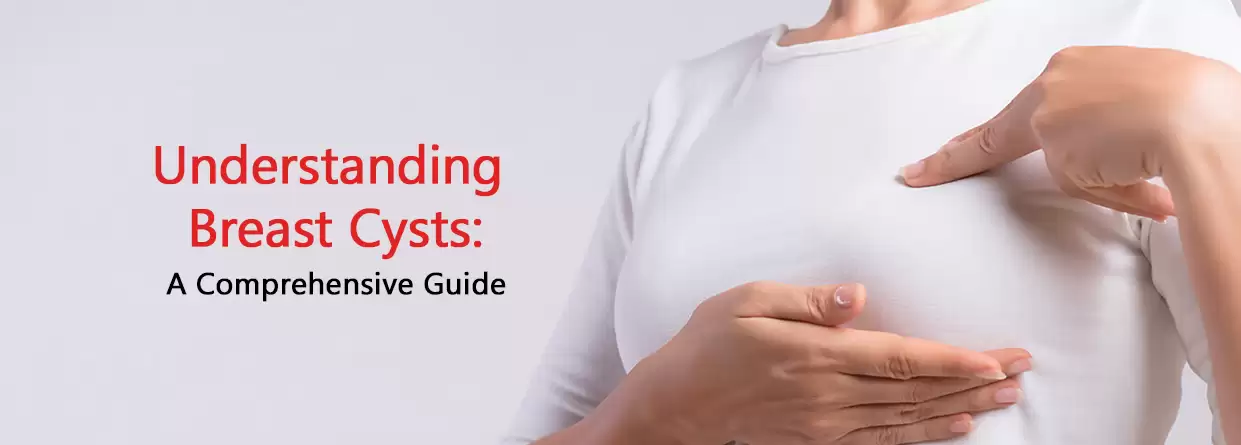 Understanding Breast Cysts: A Comprehensive Guide - CMRI