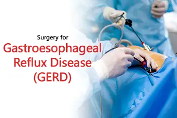 GERD Treatment: Everything You Need to Know for Lasting Relief