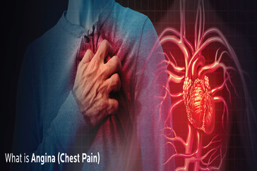 What Should You Know About Angina? - Chest Pain