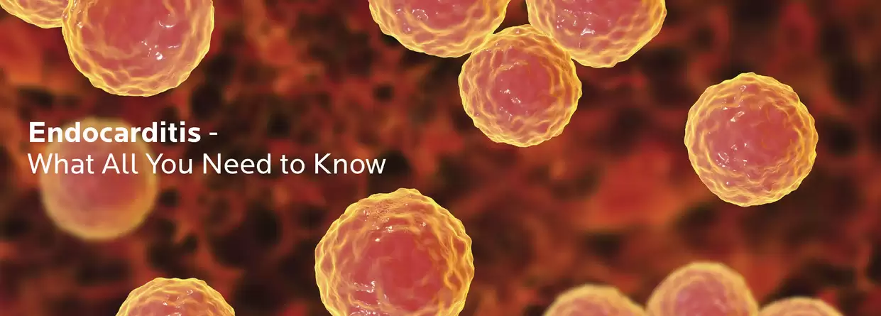 What is Endocarditis? - Causes, Symptoms & Treatments