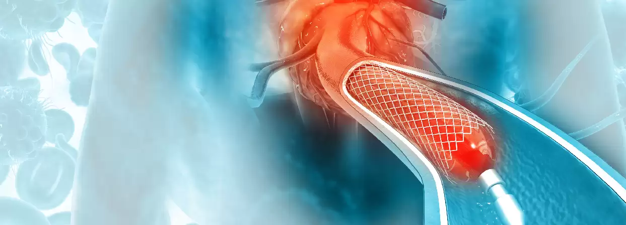 What is a CABG Procedure and Why is it Required - RBH