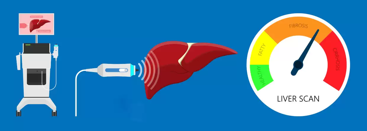 Fibroscan A New And Simple Method For Liver Biopsy Rbh