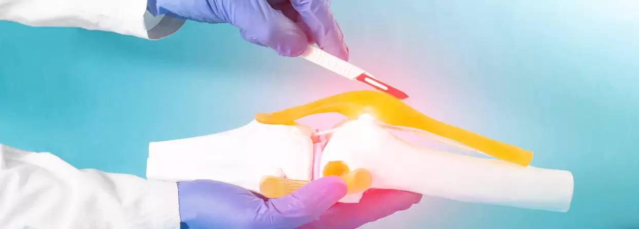 Arthroscopy: Reasons, Procedure and Benefits - RBH