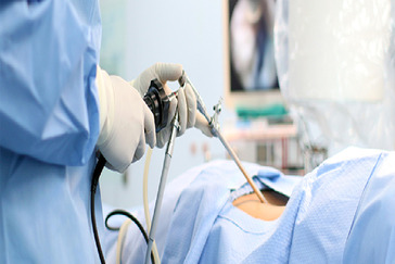 Laparoscopic Surgery for Gastrointestinal Disorders - RBH