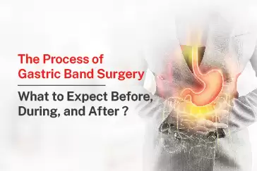 Gastric Band Surgery: Step-by-Step Process & What to Expect