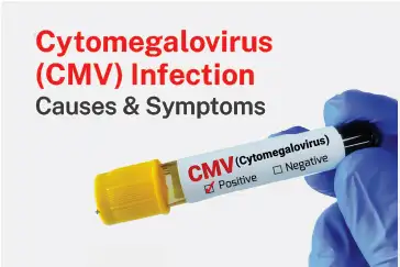 Cytomegalovirus (CMV) infection - Symptoms, causes & Treatment - RBH