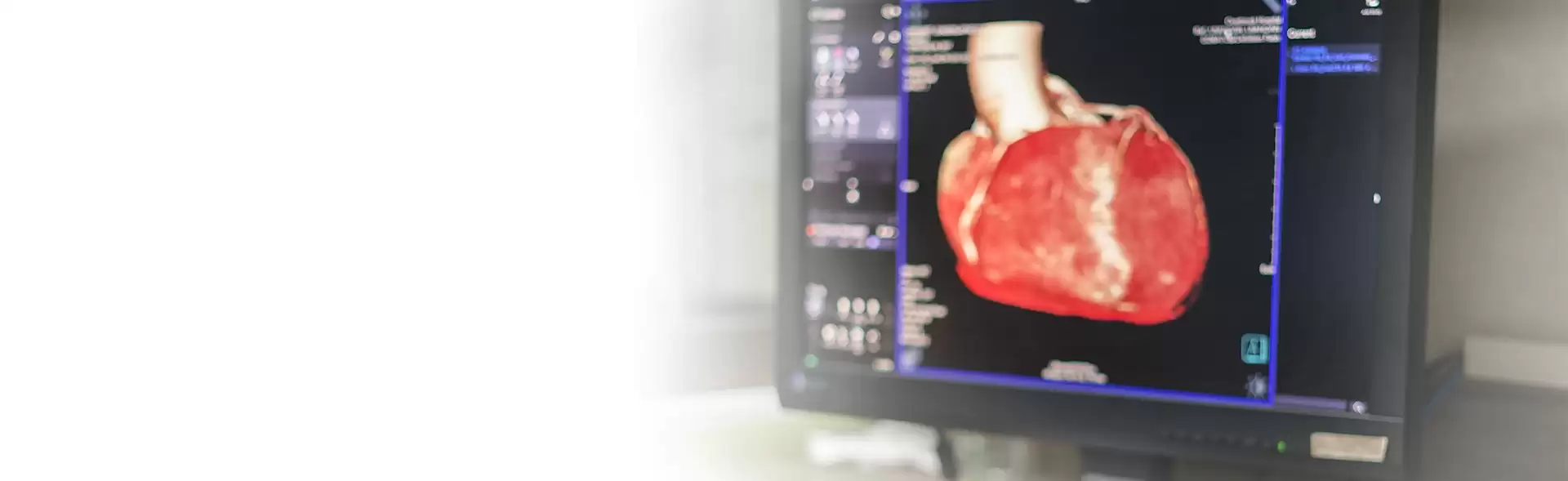 CT Angiography in Jaipur | CK Birla Hospital