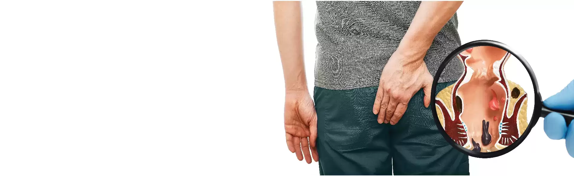 Anal Fissure Treatment in Jaipur | Painless Procedure & Expert Surgeons