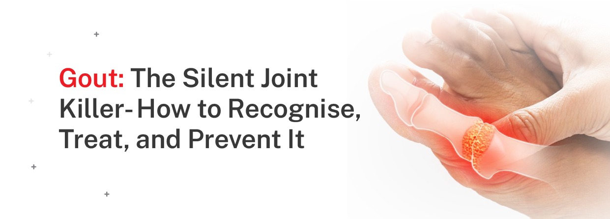Gout: The Silent Killer Damaging Joints– Signs, Treatment & Prevention