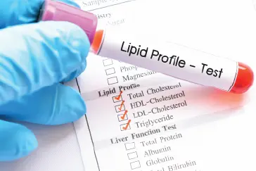 Lipid Profile Test: Cholesterol Levels, Purpose & Heart Health