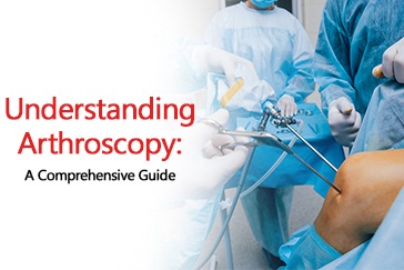 Arthroscopy: Types, Causes & Key Benefits